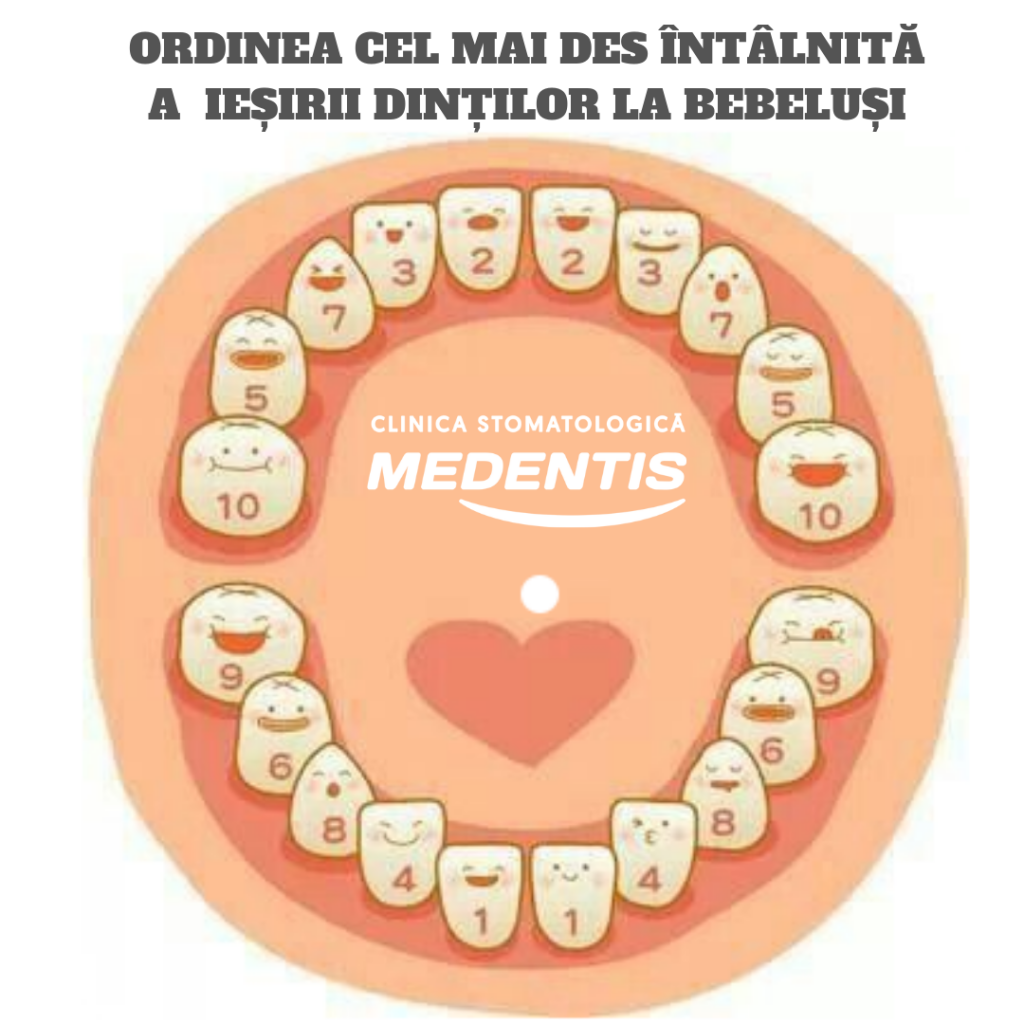 Pedodonția – stomatologia pediatrică – Clinica Medentis